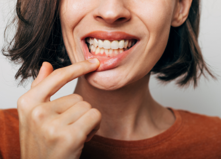Early Signs of Gum Disease? Here’s How to Manage Bleeding Gums